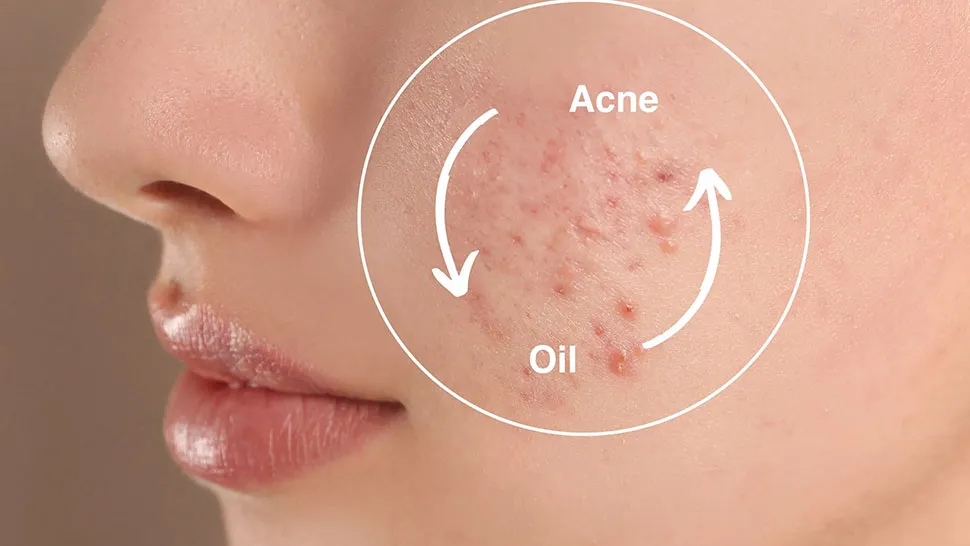Skin Care Routine for Breakouts - Age Defying Skin Care By Dr. J | MiamiMD